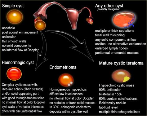 Paratubal Cyst Size Chart Characteristics Of The Paraovarian