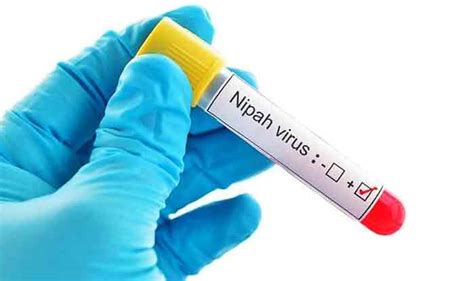 Nipah Virus Infection Source Not Bat Or Any Other Animal Reveal Test Nipah Virus Infection Source Not Bat Or Any Other Animal Reveal Test