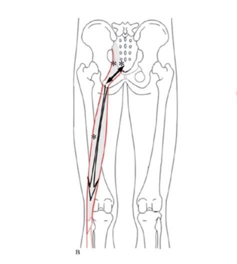 Hamstring Injuries What Role Does The Lumbar Spine And Pelvis Play Fmpa