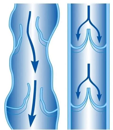 Venous Disease Classification And Description Diseases And Conditions