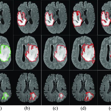 Segmentation And Corresponding Comparison Of Synthetic And Real Images