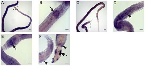 Tissue Localization Of Phytochelatin Synthase Expression By Wish Boxed