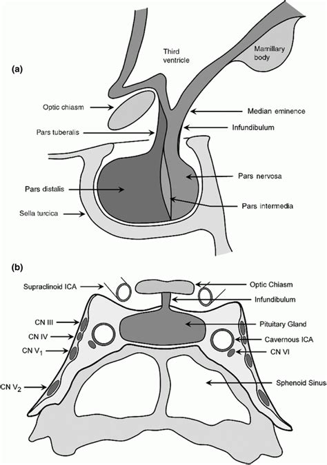 Transsphenoidal Hypophysectomy Anesthesia Key Transsphenoidal Hypophysectomy Anesthesia Key