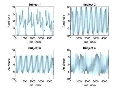 samples of four different waveforms of 15 second ppg segments