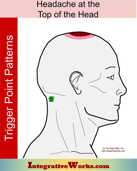 Headache On The Top Of Your Head Integrative Works