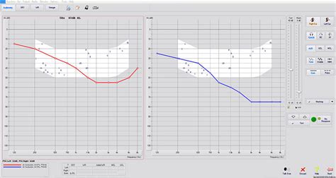 Avant Software Computer Based Audiometry Software Medrx