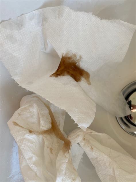 Bloody Show Mucus Plug Had A Sweep Done Yesterday Came Home Had A Bloody Discharge Clumps In