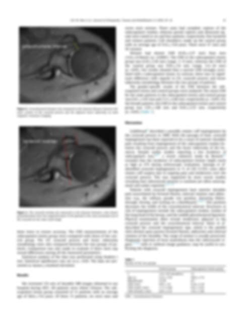 Solution Magnetic Resonance Imaging Of The Subcoracoid Region And Its Relationship With
