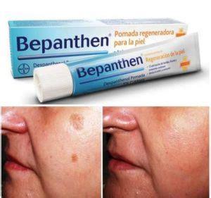Para Qué Sirve La Crema Bepanthen Y Cómo Utilizarla « Todo Nathy
