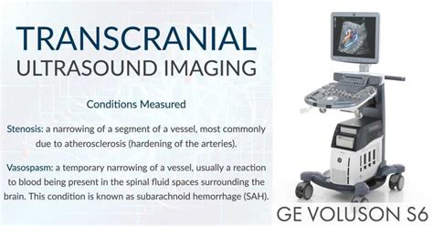 Voluson S6 Ultrasound In Womens Healthcare Marcroft Medical Voluson S6 Ultrasound In Womens Healthcare Marcroft Medical