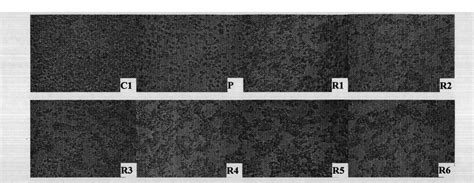 Application Of Recombinant Ganoderma Lucidum Immunoregulatory Protein