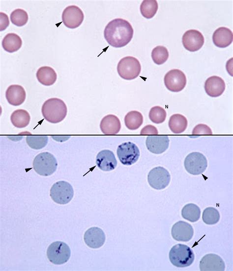 Regenerative Anemia In A Cat Eclinpath