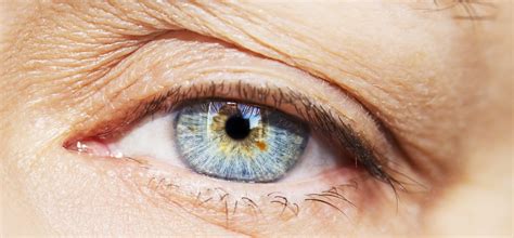 Types Of Eyelids