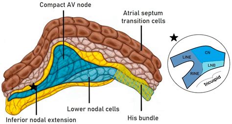 Relevance Of Anatomical Significance Of Av Nodal Structures Within Kochs Triangle And Pyramid