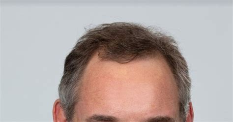 The Future Of Healthcare With Eric Rosow Ceo Of Diameter Health Thrive Global Tomorrowsworld