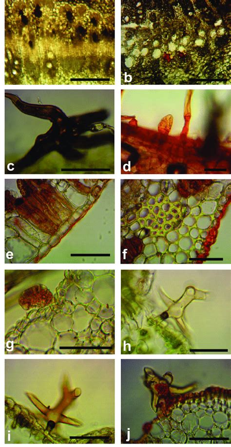 Stem And Leaf Of Erythrina Velutina Willd Fabaceae Structure And