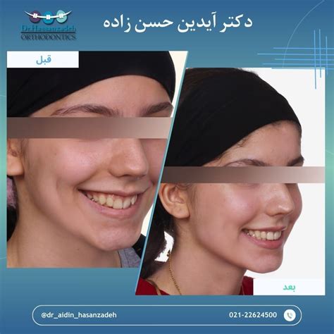 ‎دکتر آیدین حسن‌زاده متخصص ارتودنسی در تهران‎ ‎همان دندان‌ها اما