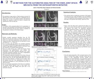 Automated MRI Based 3D Joint Space Analysis PPT