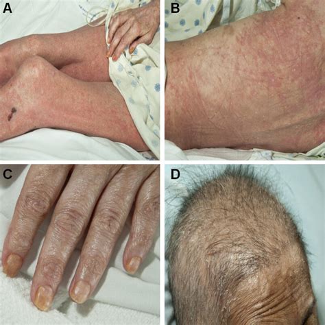 Physical Findings Of Arsenic Toxicity Download Scientific Diagram