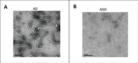 Fibrillar Polymers From A Cell Extract Of Temporal Lobe Of A An Download Scientific Diagram