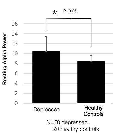 The Impact Of Individual Differences In Neuroimaging Data Sapien Labs Shaping The Future Of