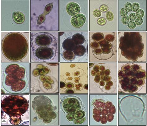 Haematococcus Pluvialis Redefining Biotechnology
