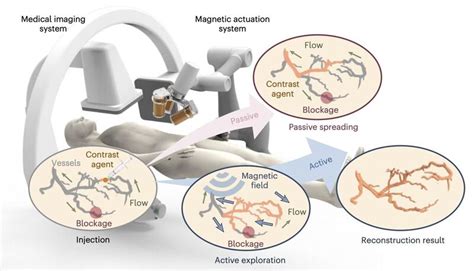 magnetic microrobot swarm enables 3d imaging of vascular networks