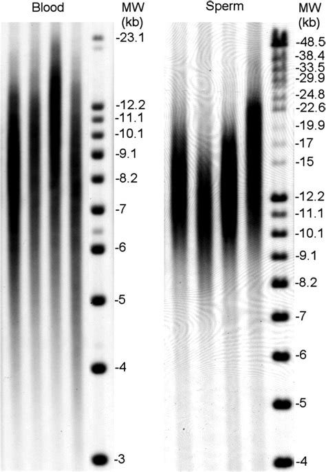 Representative Southern Blots Of The Terminal Restriction Fragments Download Scientific Diagram