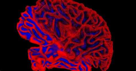 Meet The Neuralink Cofounder Who Left And Started A Competitor Thats Now Rapidly Catching Up Meet The Neuralink Cofounder Who Left And Started A Competitor Thats Now Rapidly Catching Up