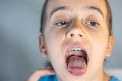 Uma Menina Abre A Boca E Mostra A Língua Foto Grátis