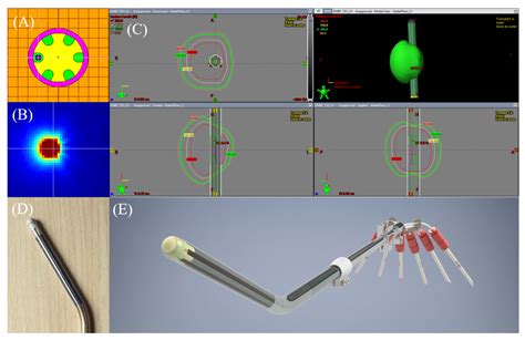 A Novel Workflow With A Customizable 3d Printed Vaginal Template And A