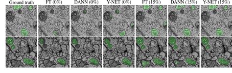 Figure From Domain Adaptive Segmentation In Volume Electron Microscopy Imaging Semantic Scholar