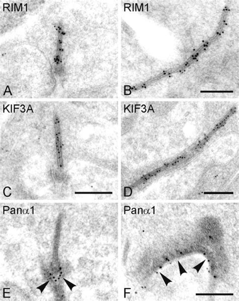 Molecular Dissection Of The Photoreceptor Ribbon Synapse Physical