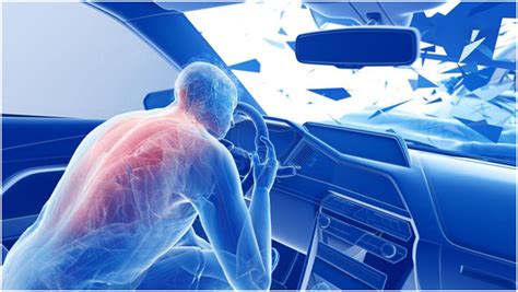 Different Types Of Back Injuries From A Accidents Fond Sector B