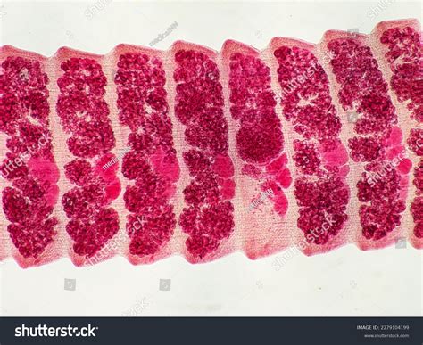 232 Imagens De Gravid Proglottid Imagens Fotos Stock E Vetores