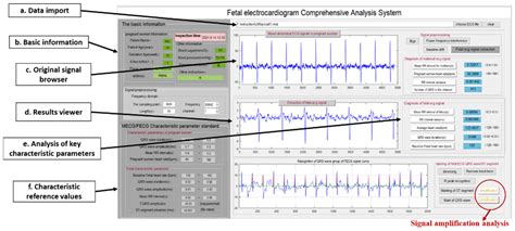 Sensors Free Full Text Fetal Electrocardiogram Signal Extraction Based On Fast Independent