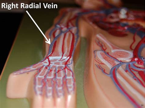 Radial Artery Location