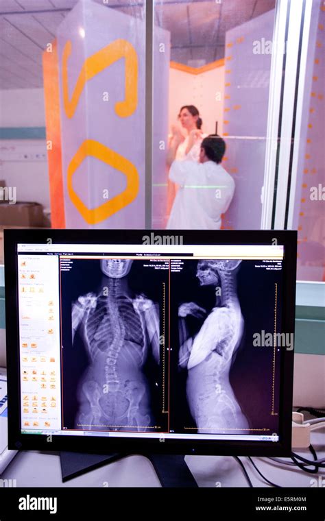 Eos Biplanar X Ray Scanner This 2d And 3d Digital X Ray Imaging