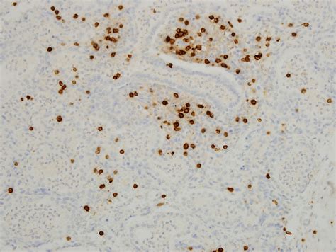identifying counting measuring stained objects in a field image