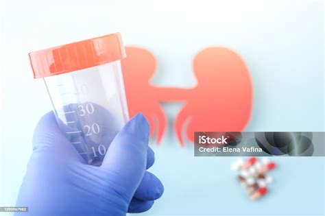 의사의 손은 소변 분석을위한 용기를 잡고 있습니다 신장 파란색 배경의 종이에서 인간의 장기 세계 신장의 날과 국가 장기 기증자의