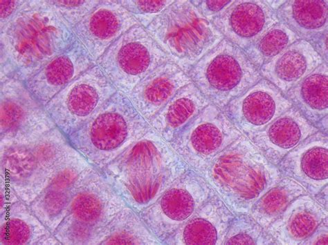Mitosis Phases Under Microscope