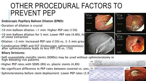 Post Ercp Pancreatitis Risk Factors Prevention Treatment Pptx