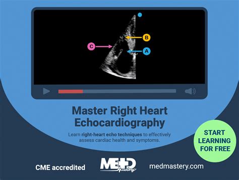 Sinoatrial Exit Block LITFL ECG Library Diagnosis