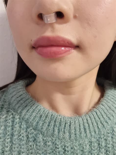 입벌림방지밴드 다소 충격적 사용후기 네이버 블로그