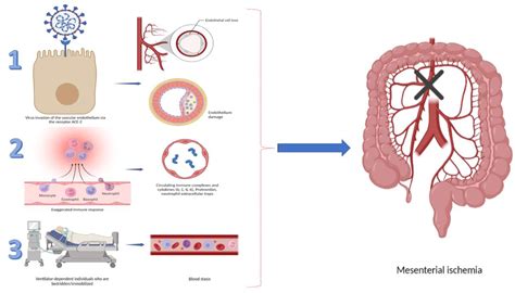 What Is A Ischemia In Arabic At Don Pursel Blog