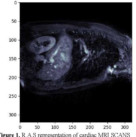 Figure 1 From Left Atrium Segmentation Using Deep Learning Model