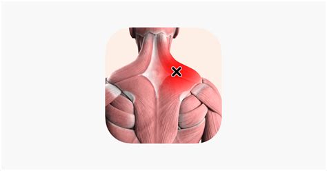 ‎app Store 上的“trigger Point Body”
