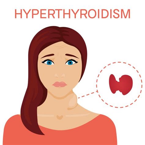 Hyperthyroidism Causes And Effective Treatments Apomuden