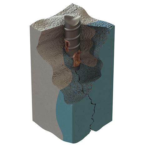 RebaGuard Galvanic Anodes Duoguard