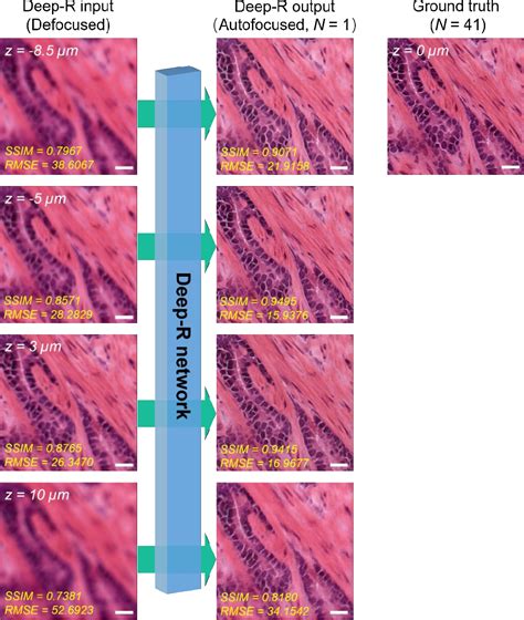 Figure 1 From Single Shot Autofocusing Of Microscopy Images Using Deep Learning Semantic Scholar